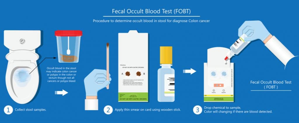 Screening for Colorectal Cancer - Screening Options - Digestive Cancer ...