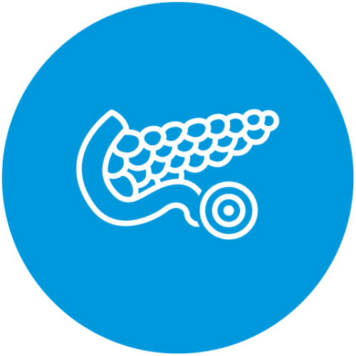 Pancreatic Cancer Risk Factors and Prevention - Digestive Cancers Europe