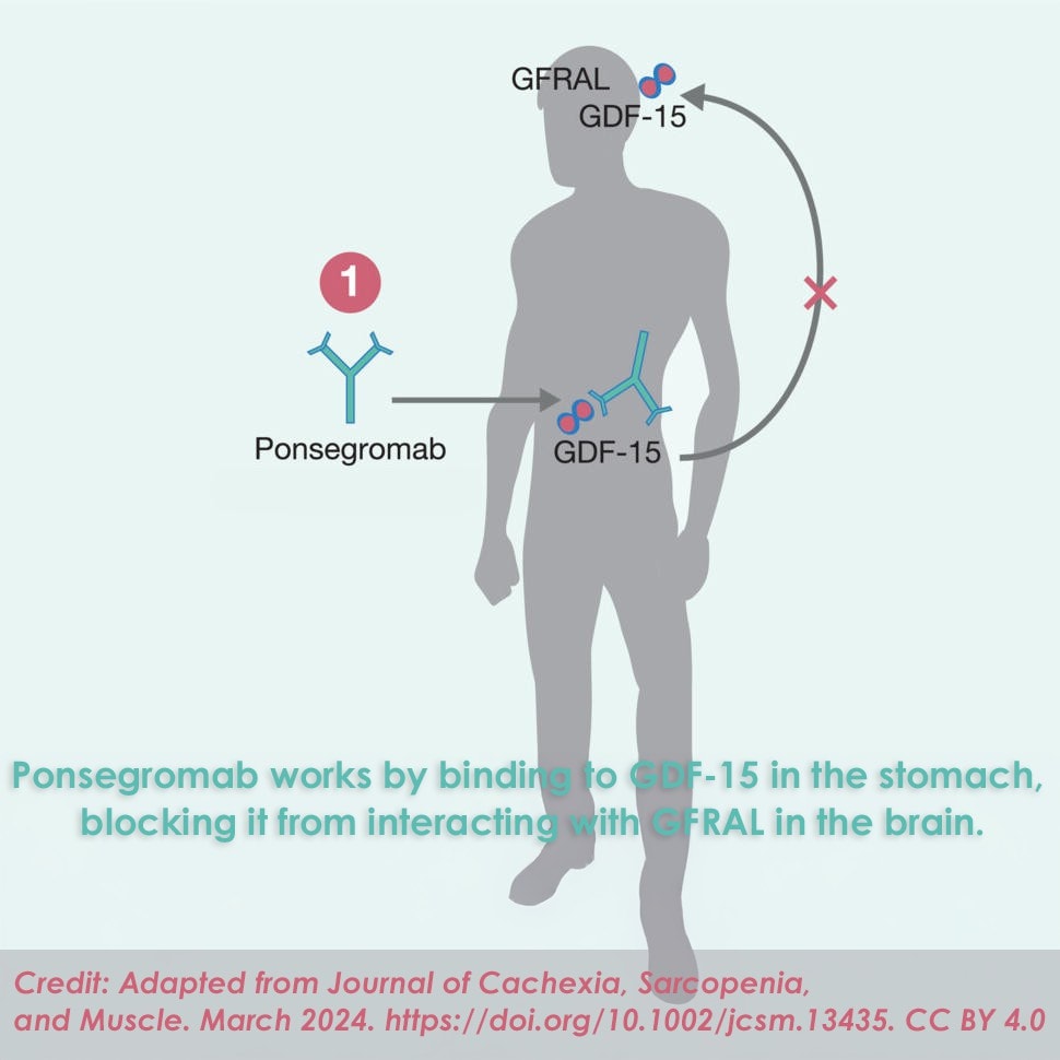 Ponsegromab: A New Hope for Cancer Cachexia Treatment - Digestive ...
